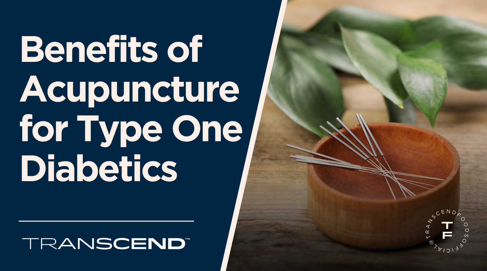 Exploring the Power of Acupuncture for Type 1 Diabetes